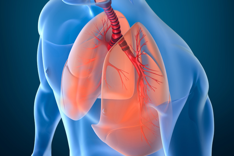 Plèvre - Chirurgien thoracique et cardio-vasculaire Nîmes